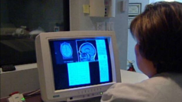 Doctors Group Private MRIs Are Barrier To Access CBC News doctors-group-private-mris-are-barrier-to-access-cbc-news