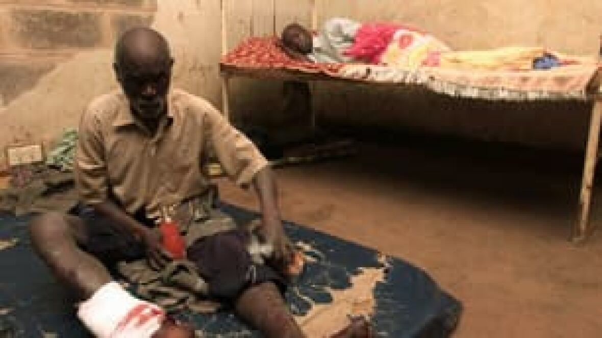 Landslides in Uganda kill 86, bury villages | CBC News Landslides in Uganda kill 86, bury villages | CBC News