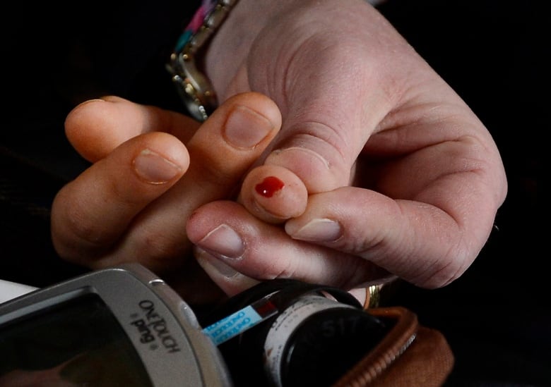 Blood Sugar Test Not Enough To Predict Heart Disease CBC News