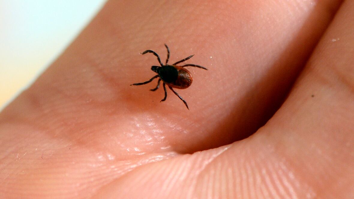 Lyme Group Expects Bad Tick Year In Manitoba Manitoba CBC News
